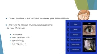 Congenital nasal obstruction | PPTX