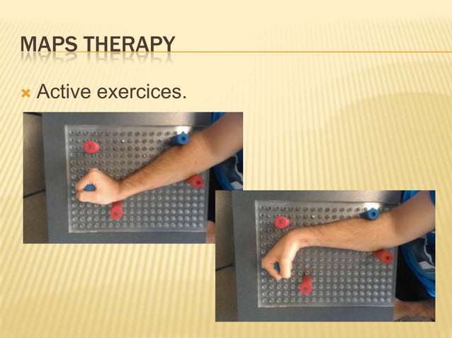 Wrist Stiffness Treatment with MAPS Therapy - Albert Dominguez Arasa | PPT