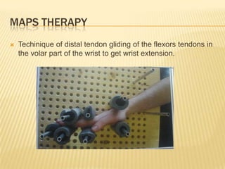 Wrist Stiffness Treatment with MAPS Therapy - Albert Dominguez Arasa | PPT