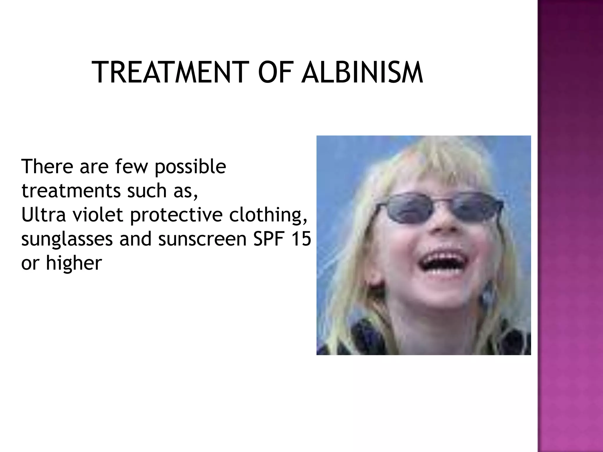 Albinism | PPTX