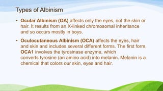 Albinism | PPTX