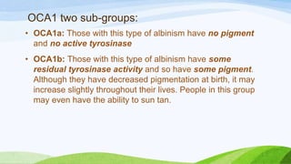 Albinism | PPTX