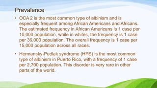 Albinism | PPTX