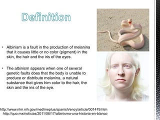 Albinism | PPTX