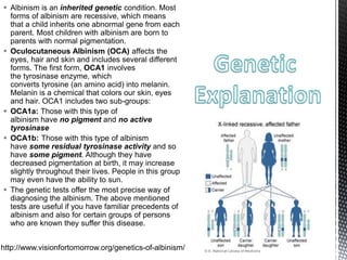 Albinism | PPTX