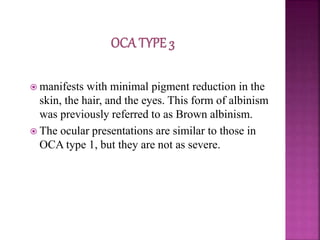 Albinism | PPTX