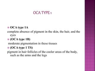 Albinism | PPTX