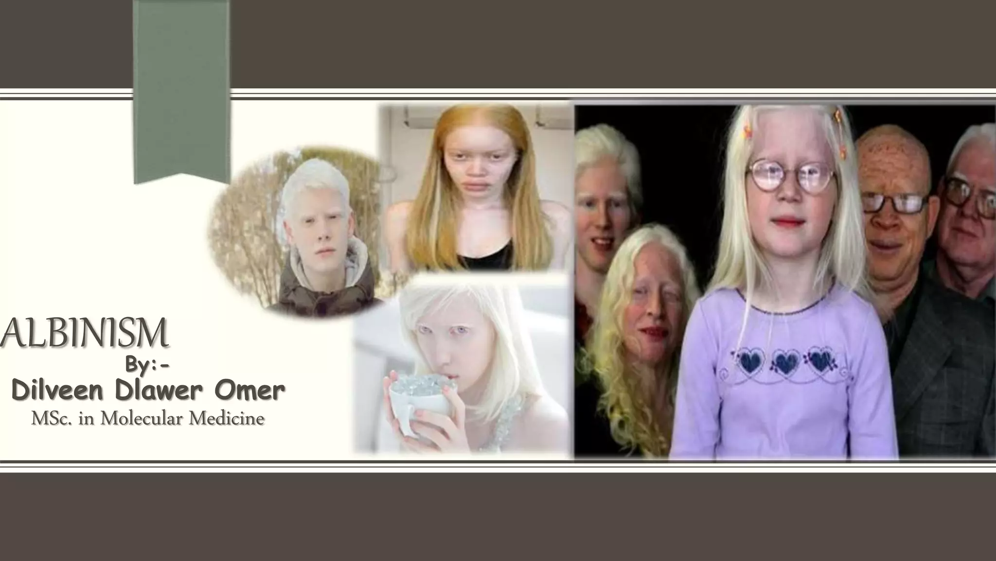 Albinism | PPTX | Eye and Vision Conditions | Diseases and Conditions