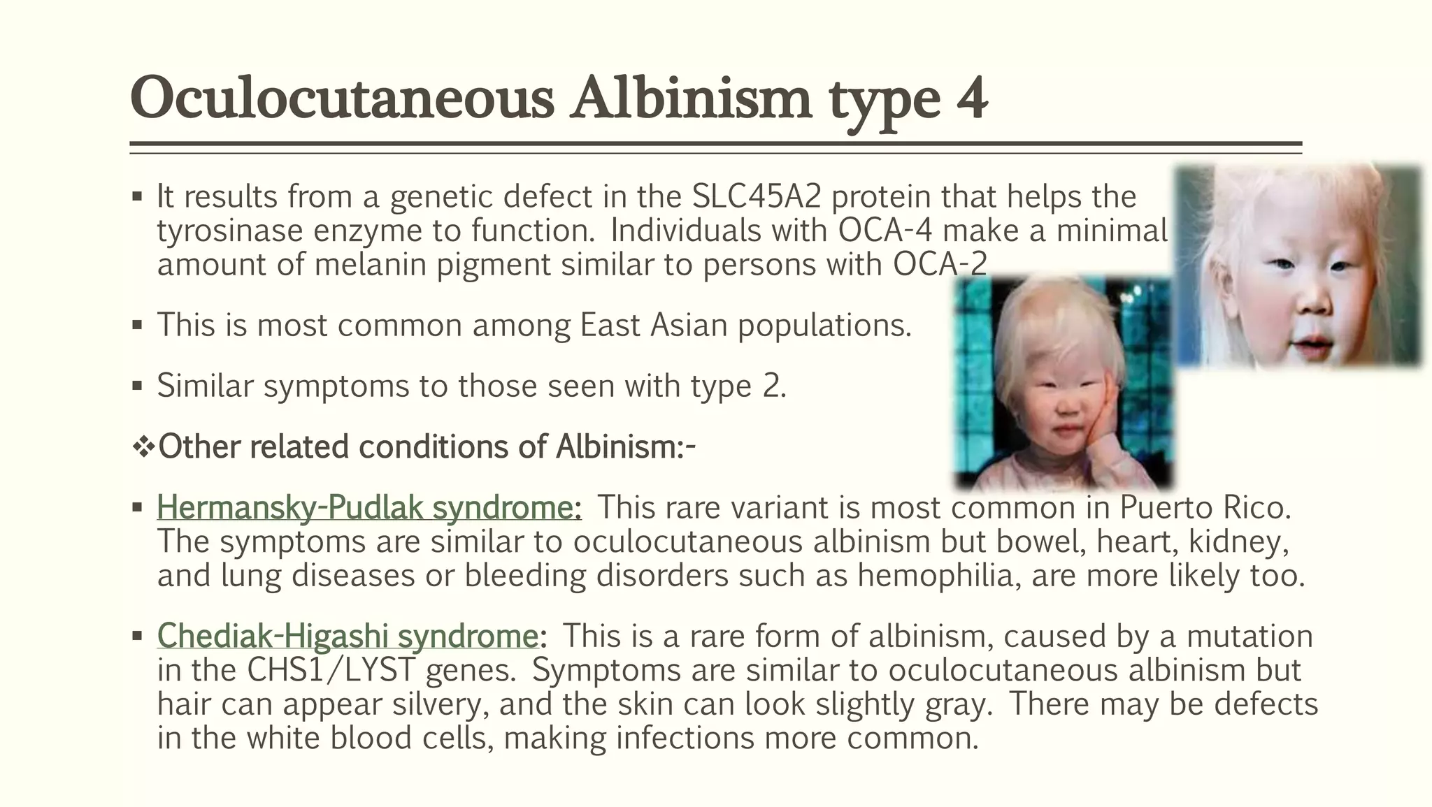Albinism | PPTX