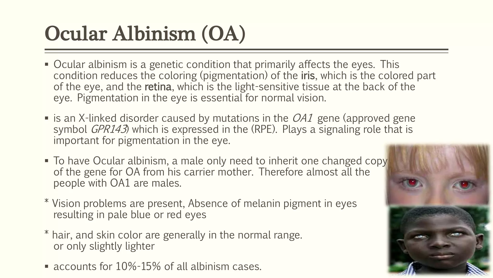 Albinism | PPTX