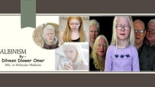 Albinism | PPTX