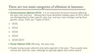 Albinism | PPTX