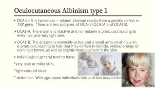 Albinism | PPTX