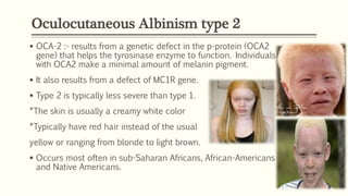 Albinism | PPTX