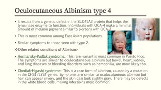 Albinism | PPTX