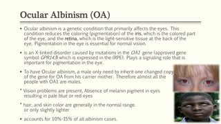Albinism | PPTX