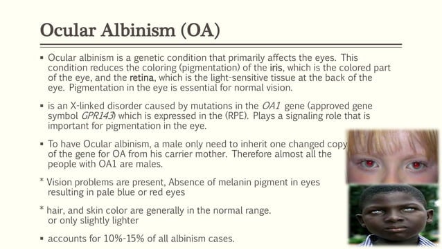 Albinism | PPTX | Eye and Vision Conditions | Diseases and Conditions