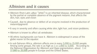 Albinism | PPTX