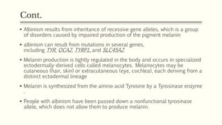 Albinism | PPTX