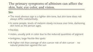 Albinism | PPTX