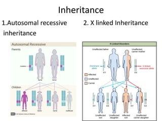 Albinism | PPTX