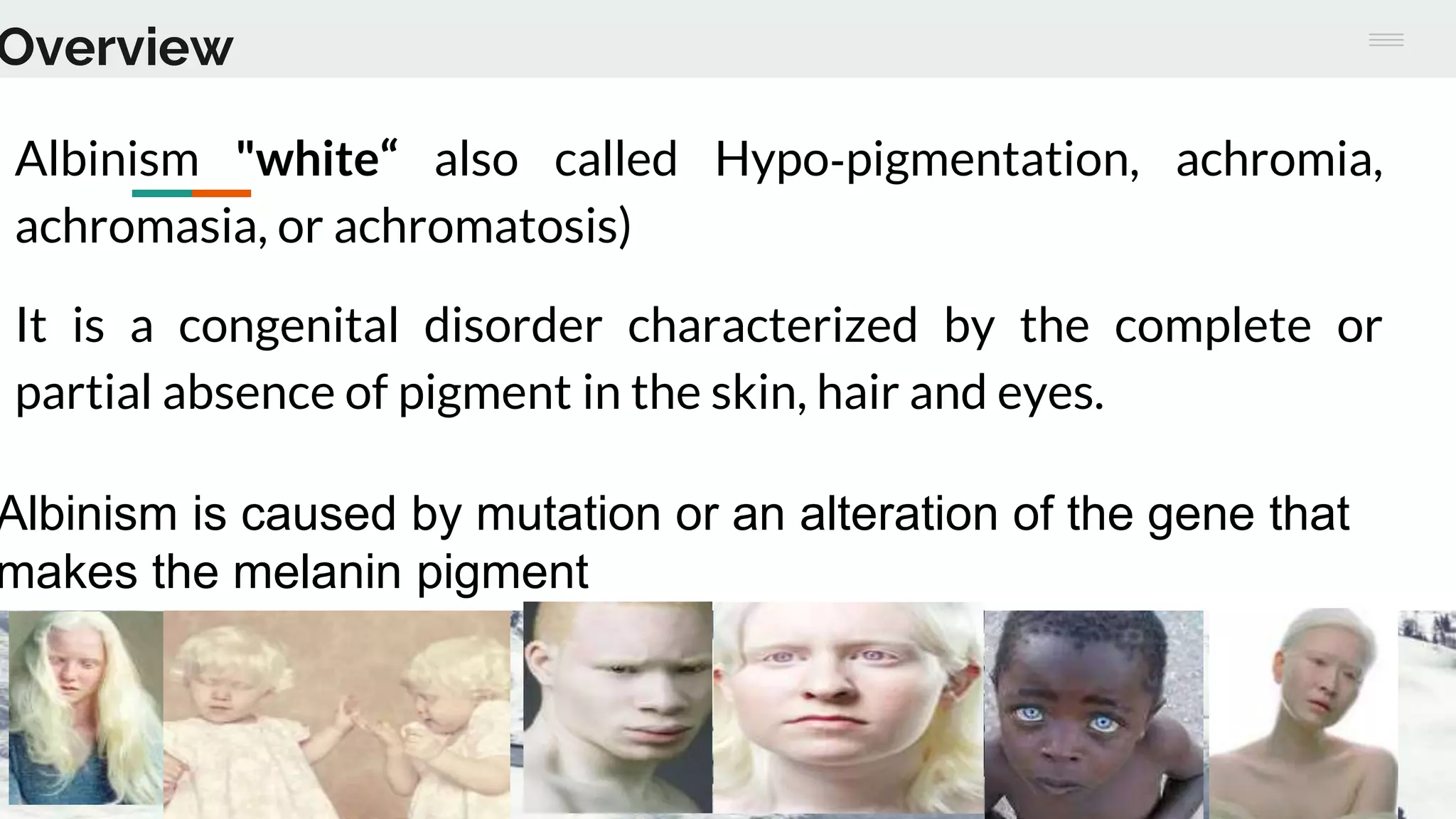 Albinism | PPTX