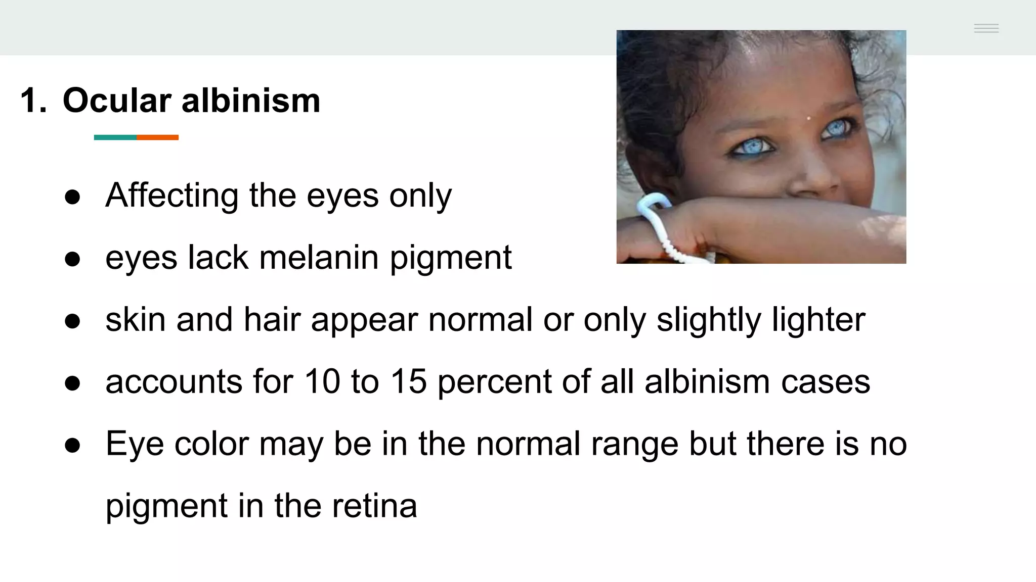 Albinism | PPTX