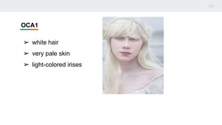 Albinism | PPTX