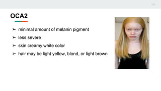 Albinism | PPTX