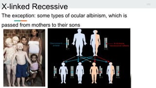 Albinism | PPTX