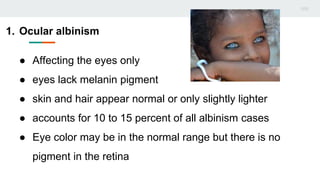 Albinism | PPTX