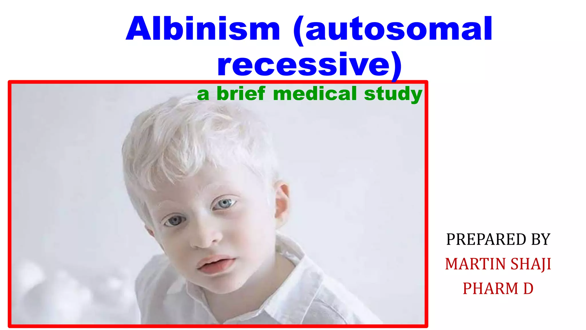 Albinism (autosomal recessive)-a brief medical study | PPTX