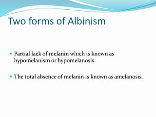 Albinism.pptx