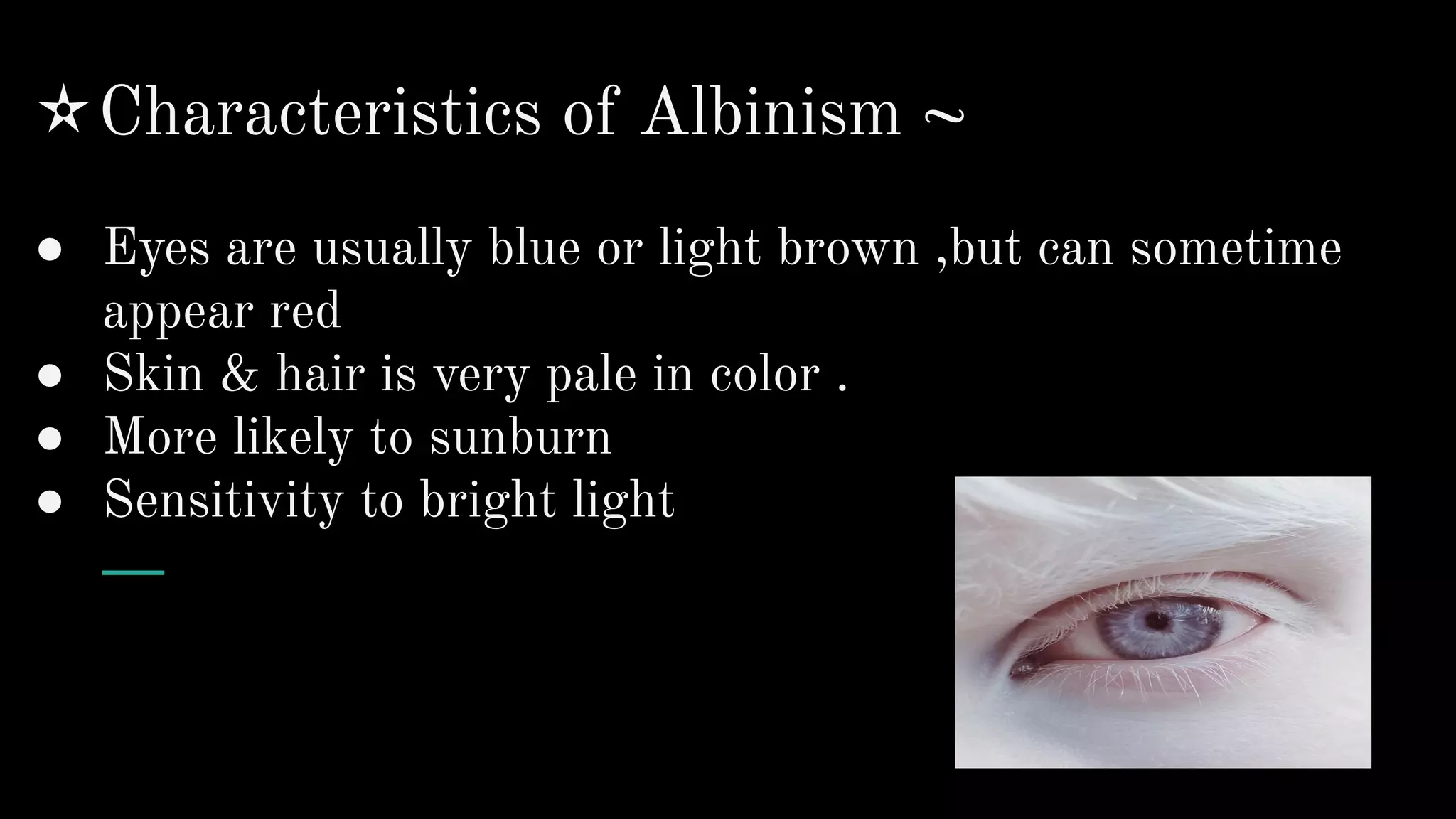 Albinism.pdf