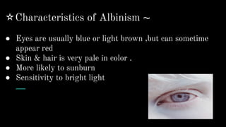 Albinism.pdf