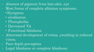 Albinism.pdf