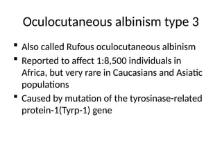 ALBINISM presentation and their effect in the eye | PPTX