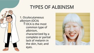 Genetic Disorders of Integumentary System including Albinism | PPTX