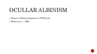 ALBINISM , definition, Inheritance, Biochemical Basis,Types ...