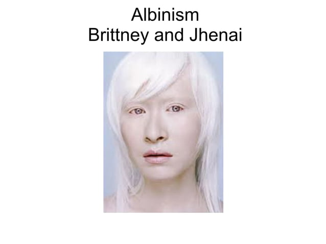 Albinismbj | ODP
