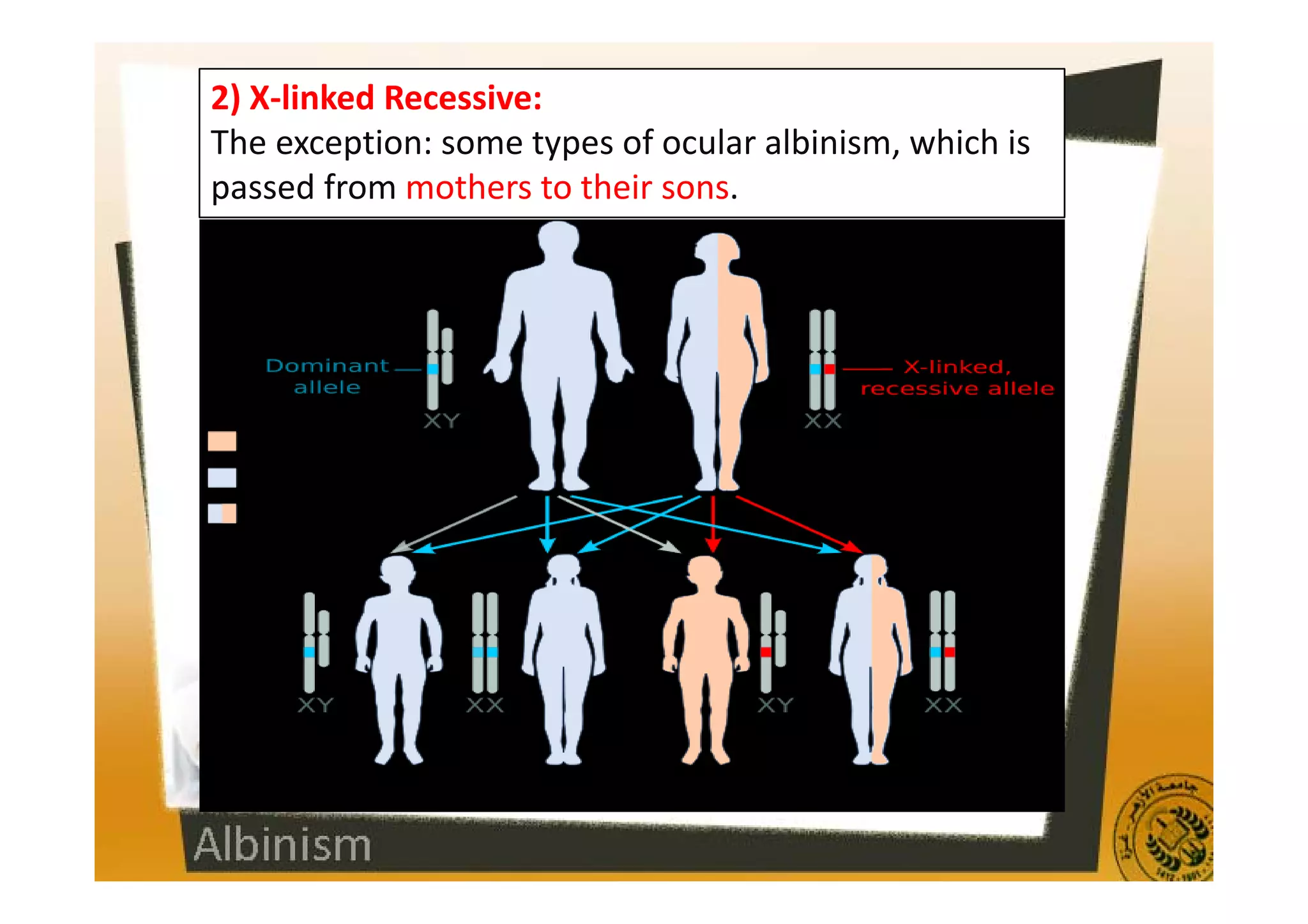 Albinism | PDF