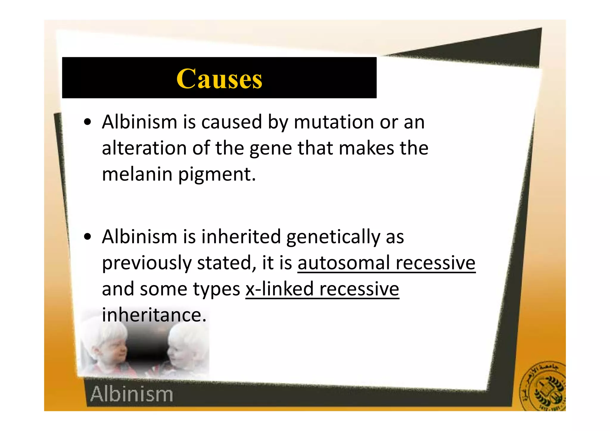 Albinism | PDF | Eye and Vision Conditions | Diseases and Conditions