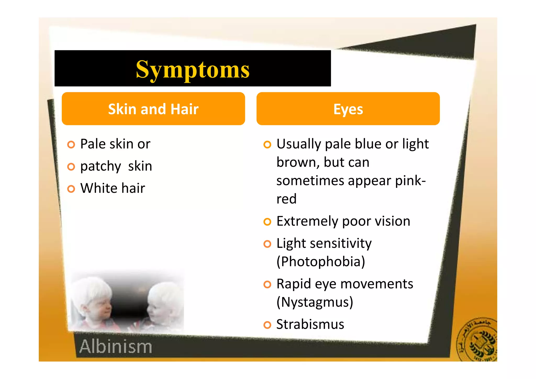Albinism | PDF | Eye and Vision Conditions | Diseases and Conditions