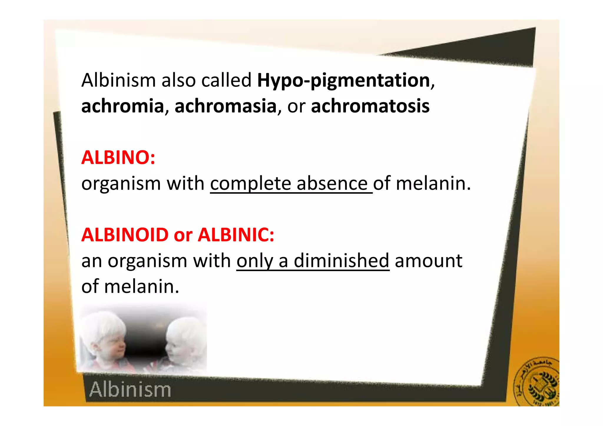 Albinism | PDF
