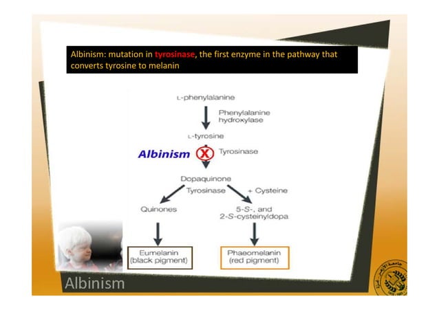 Albinism | PDF | Eye and Vision Conditions | Diseases and Conditions