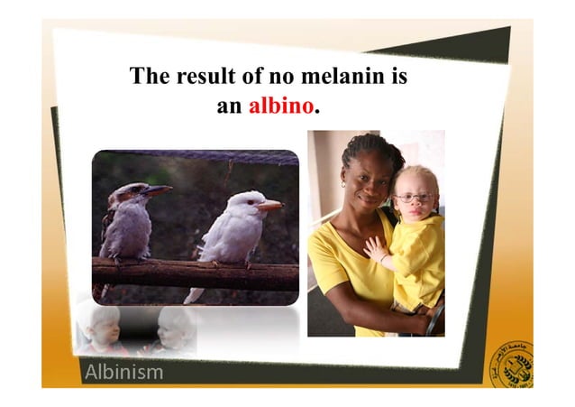 Albinism | PDF | Eye and Vision Conditions | Diseases and Conditions