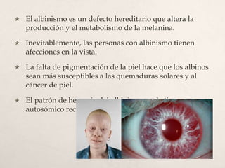 Albinismo [Clase Genetica] - Universidad del Valle de México Campus ...