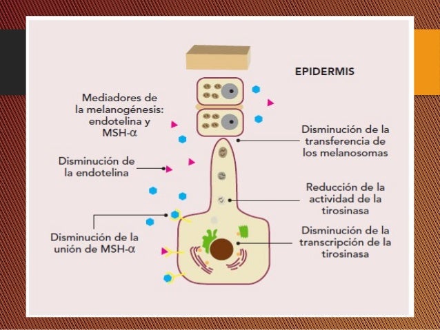 Albinismo y discapacidad