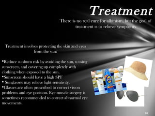 Albinism powerpoint[1] | PPT
