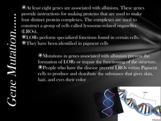 Albinism powerpoint[1] | PPT